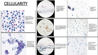 Bethesda Classification of Cervical Cytology-MANYA YADAV (1) (1).pptx