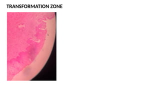 Bethesda Classification of Cervical Cytology-MANYA YADAV (1) (1).pptx