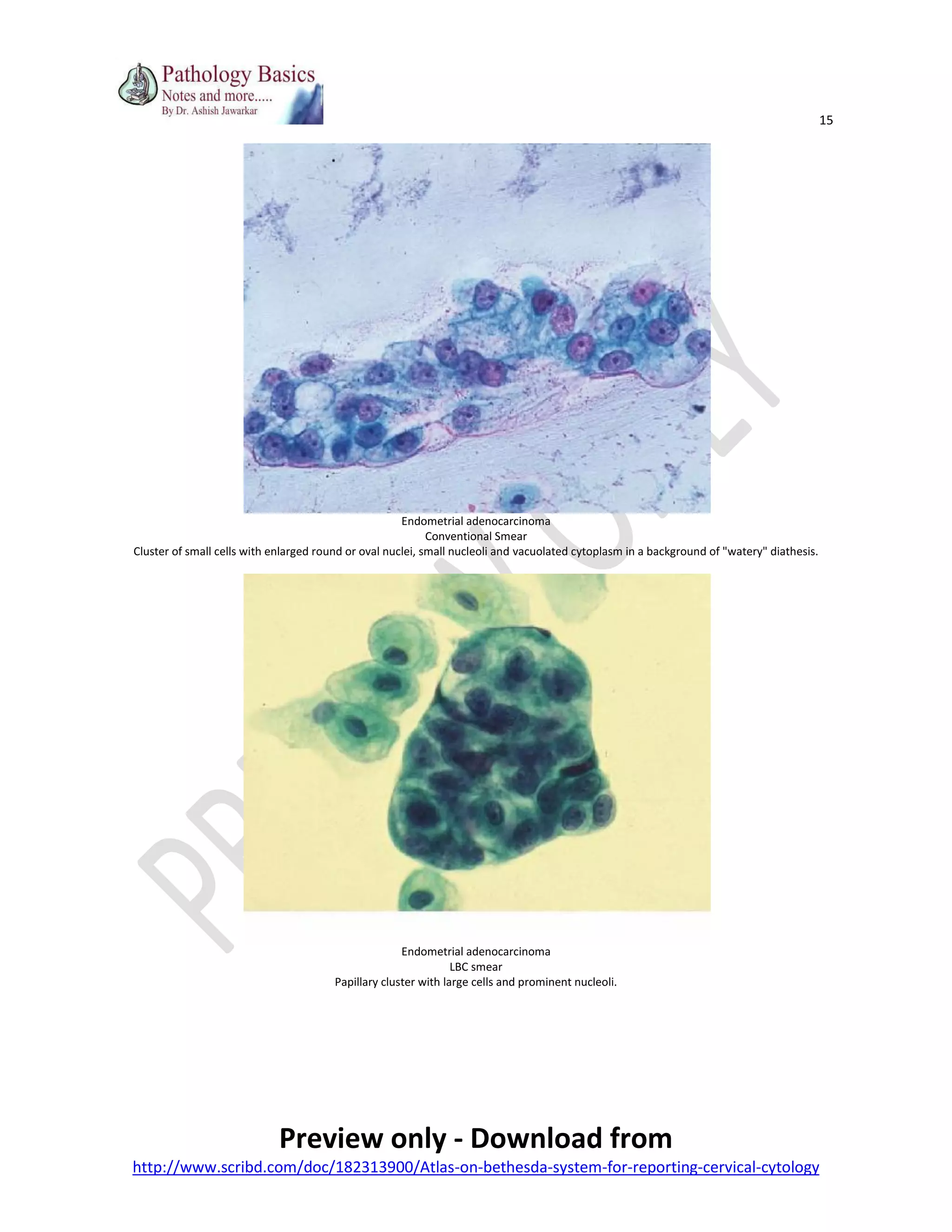 Atlas on bethesda system for reporting cervical cytology | PDF