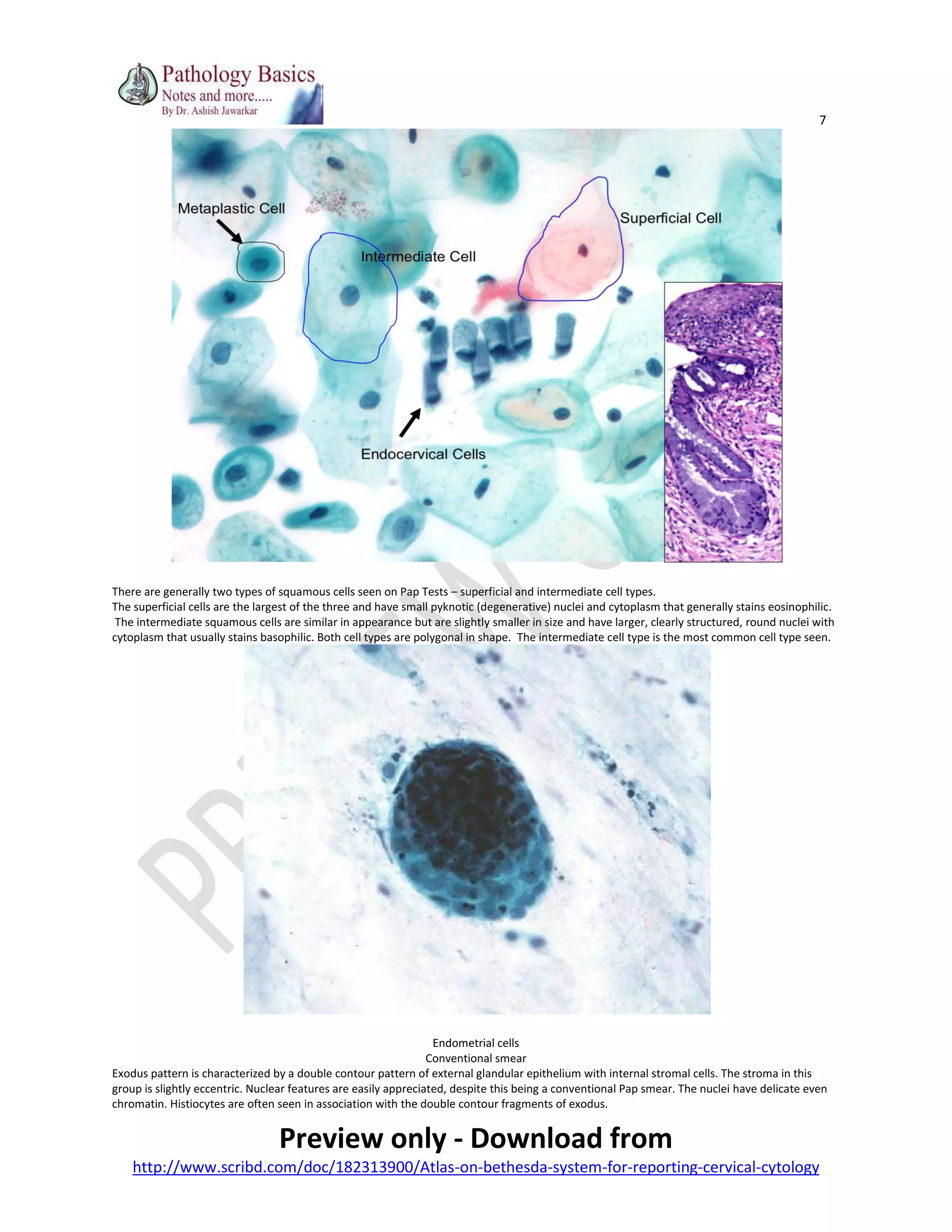 Atlas on bethesda system for reporting cervical cytology | PDF