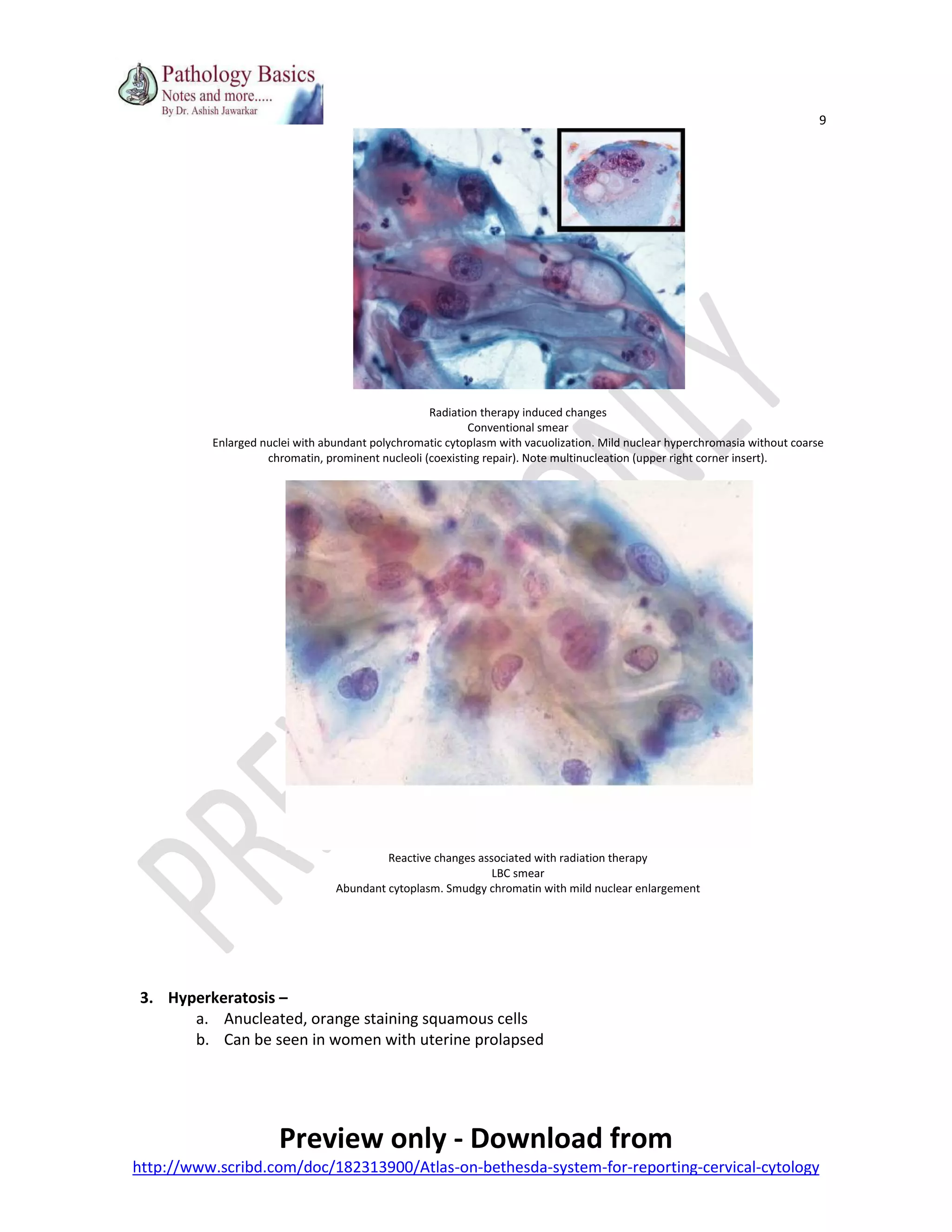 Atlas on bethesda system for reporting cervical cytology | PDF