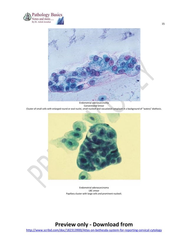 Atlas on bethesda system for reporting cervical cytology | PDF