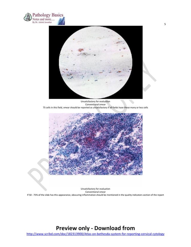 Atlas on bethesda system for reporting cervical cytology | PDF