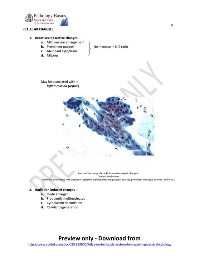 Atlas on bethesda system for reporting cervical cytology | PDF