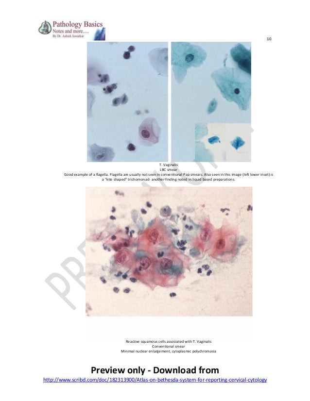 Atlas on bethesda system for reporting cervical cytology