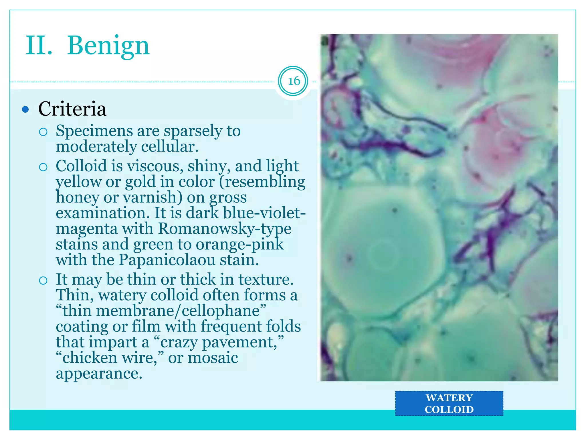 Bethesda System for thyroid cytopathology | PPTX