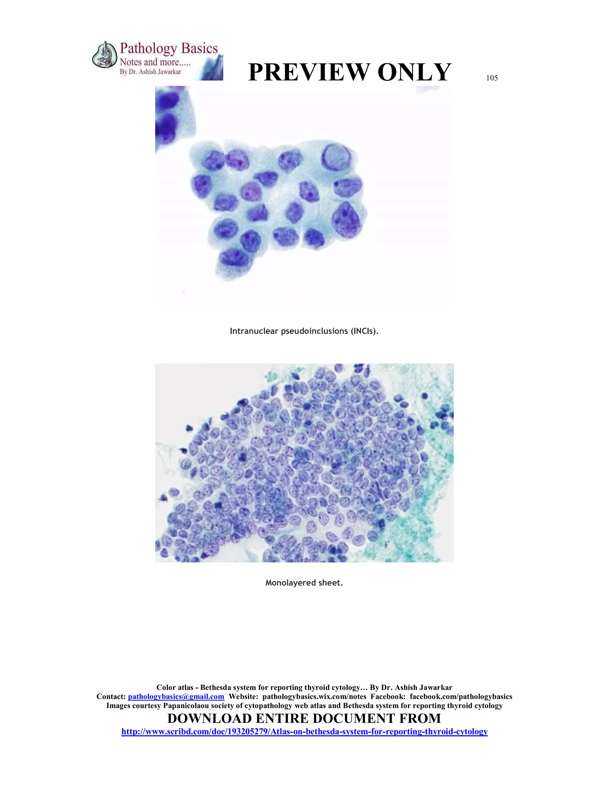 color atlas on bethesda system for reporting thyroid cytology | PDF