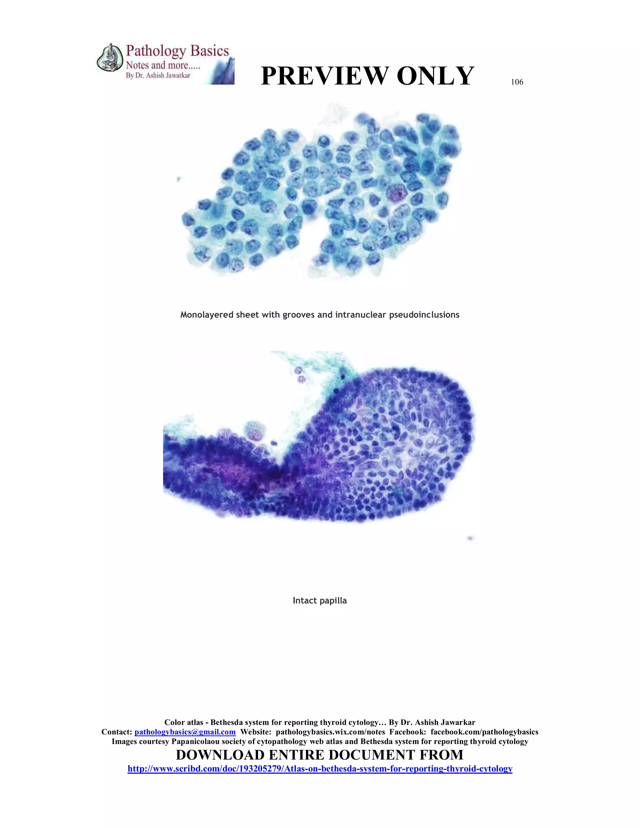color atlas on bethesda system for reporting thyroid cytology | PDF