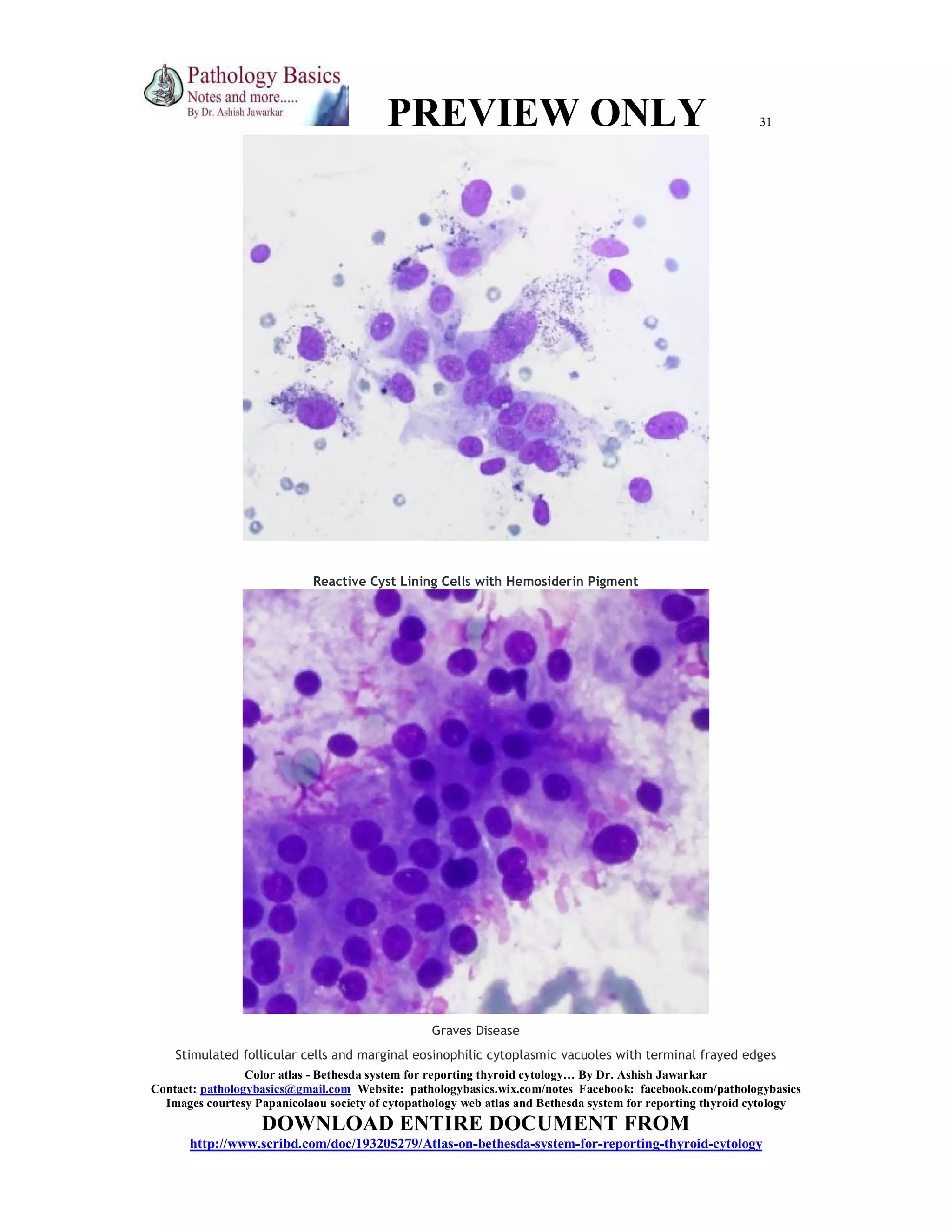 color atlas on bethesda system for reporting thyroid cytology | PDF