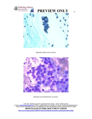 color atlas on bethesda system for reporting thyroid cytology | PDF
