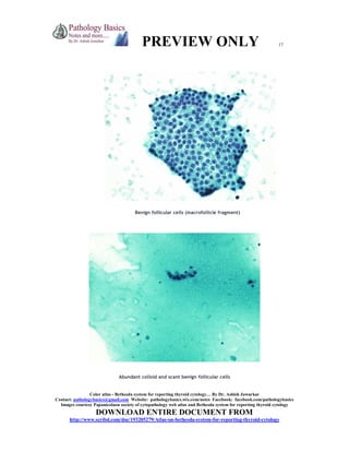 color atlas on bethesda system for reporting thyroid cytology | PDF