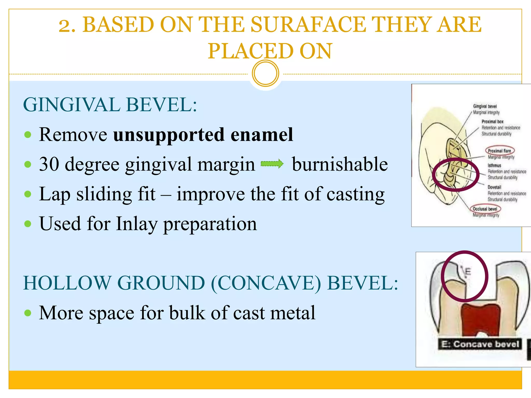 Bevels in Dental Restorations | PPTX