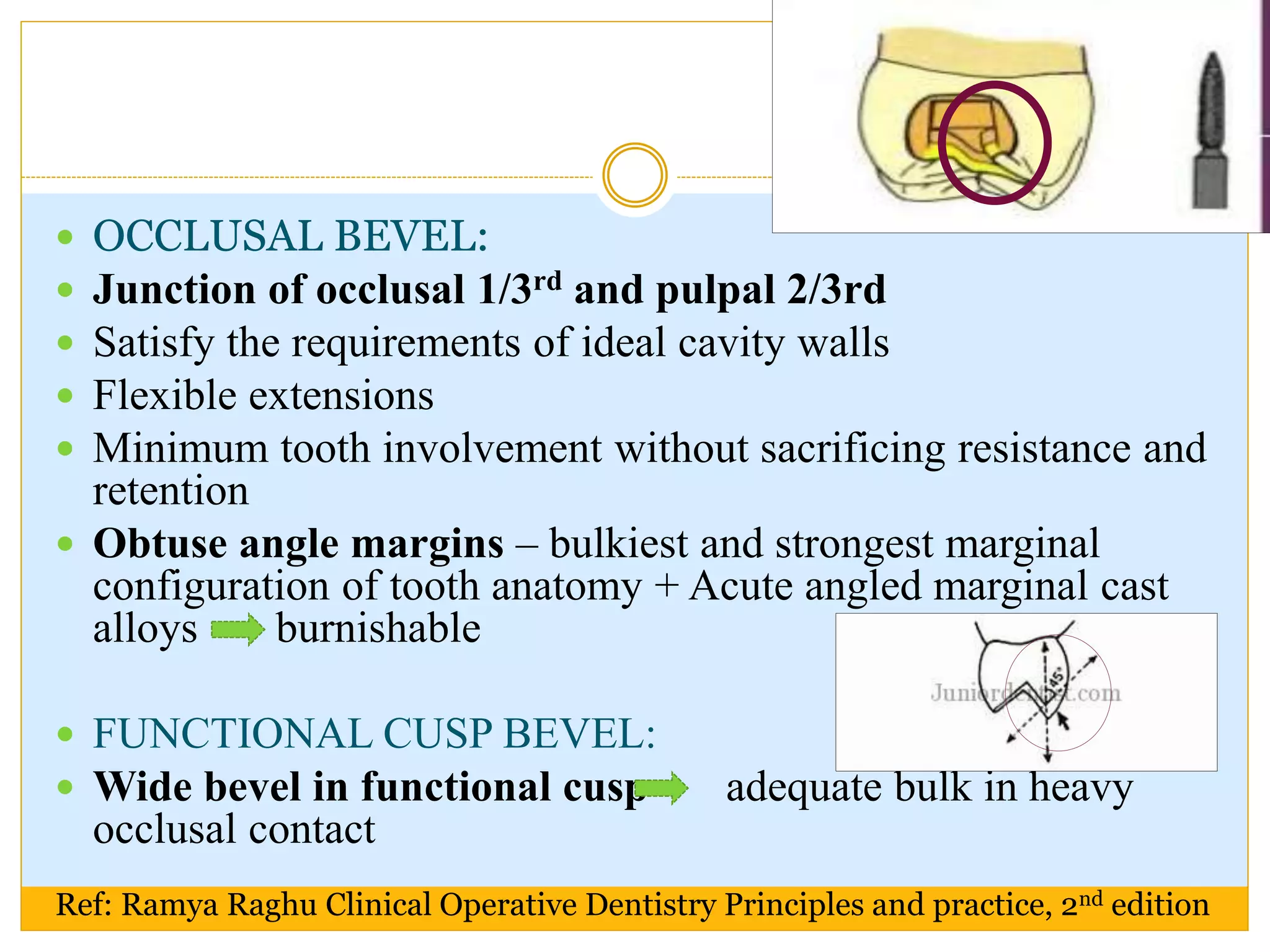 Bevels in Dental Restorations | PPTX