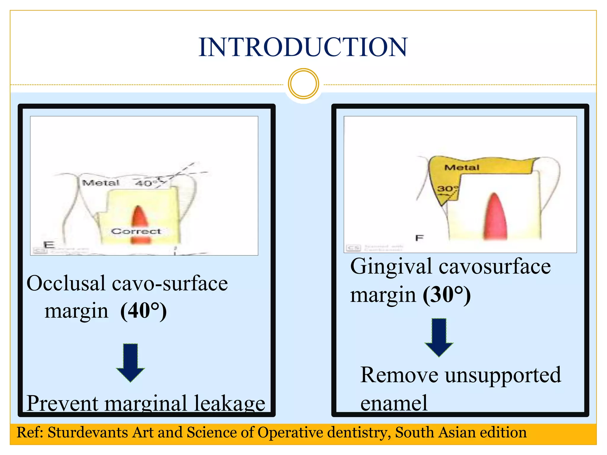 Bevels in Dental Restorations | PPTX