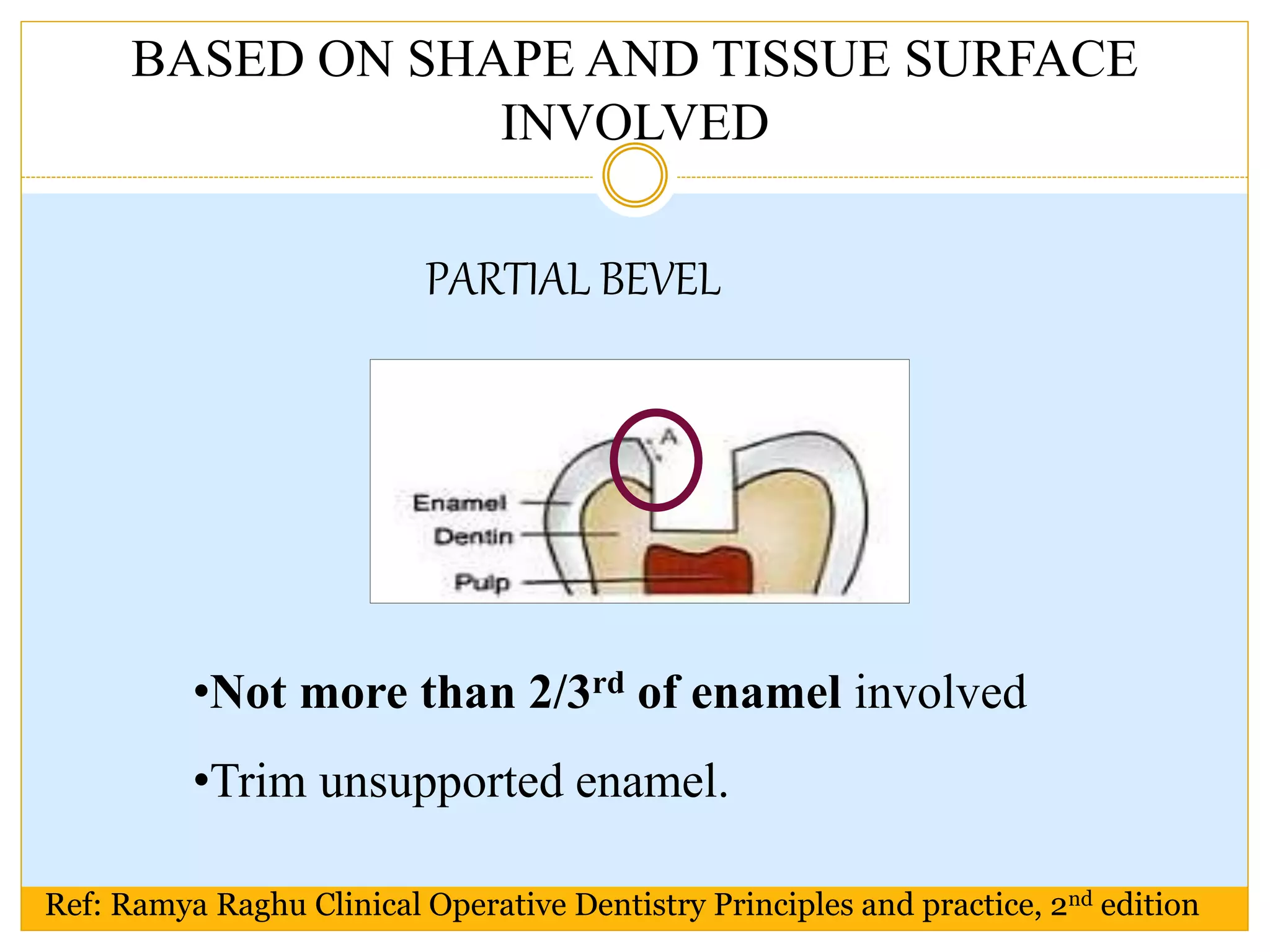 Bevels in Dental Restorations | PPTX