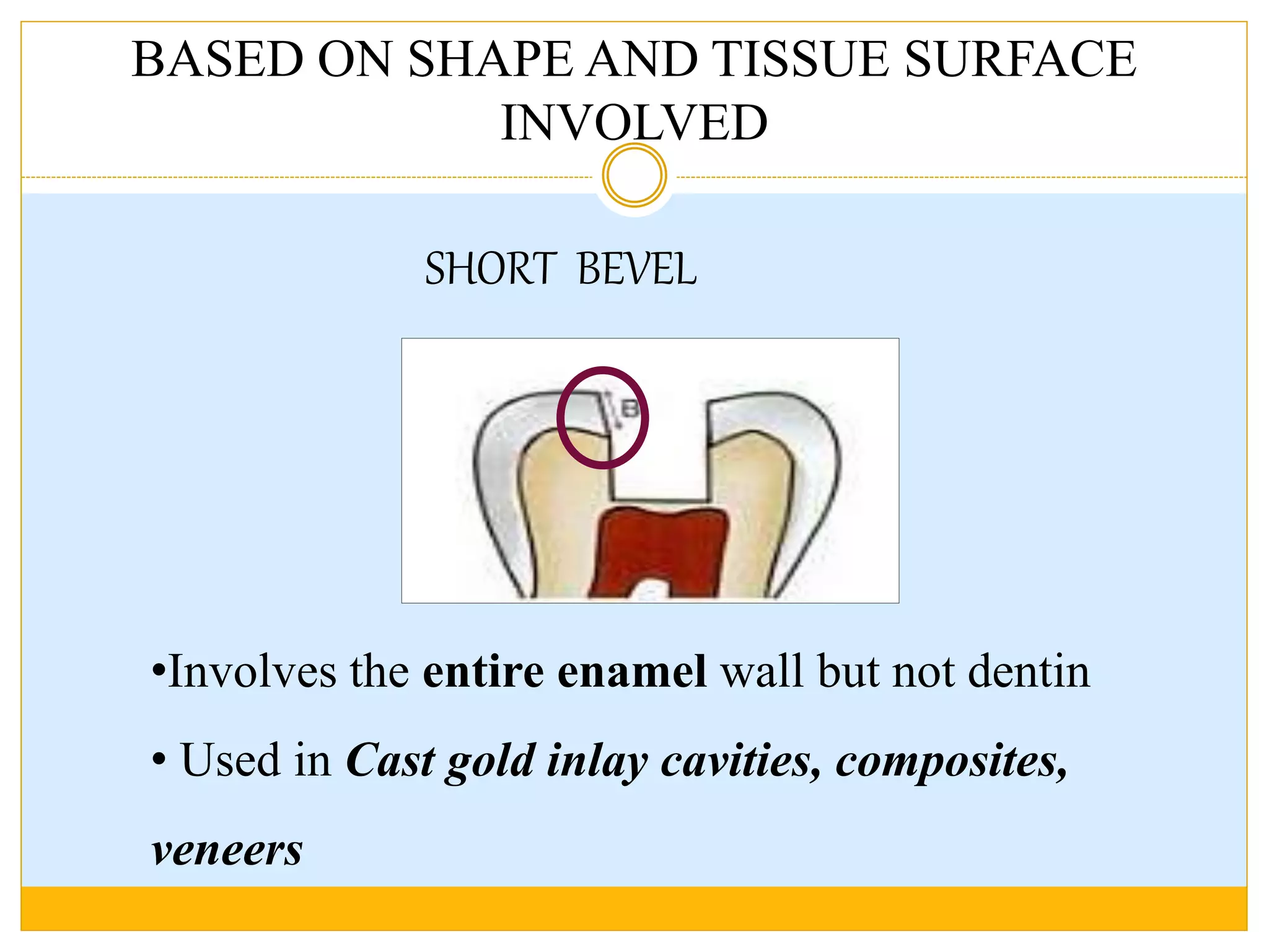 Bevels in Dental Restorations | PPTX