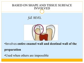 Bevels in Dental Restorations | PPTX