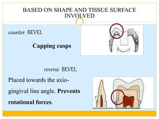 Bevels in Dental Restorations | PPTX