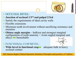 Bevels in Dental Restorations | PPTX