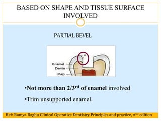 Bevels in Dental Restorations | PPTX