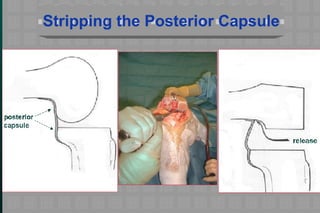 Beverland D. Surgical Factors Influencing Rom | PPT | Physical Therapy ...