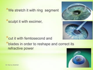 Beware of the monster; postlasik ectasia | PPT