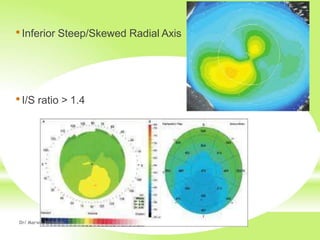 bewareofthemonsterpostlasikectasia-170726215407 (1).pptx
