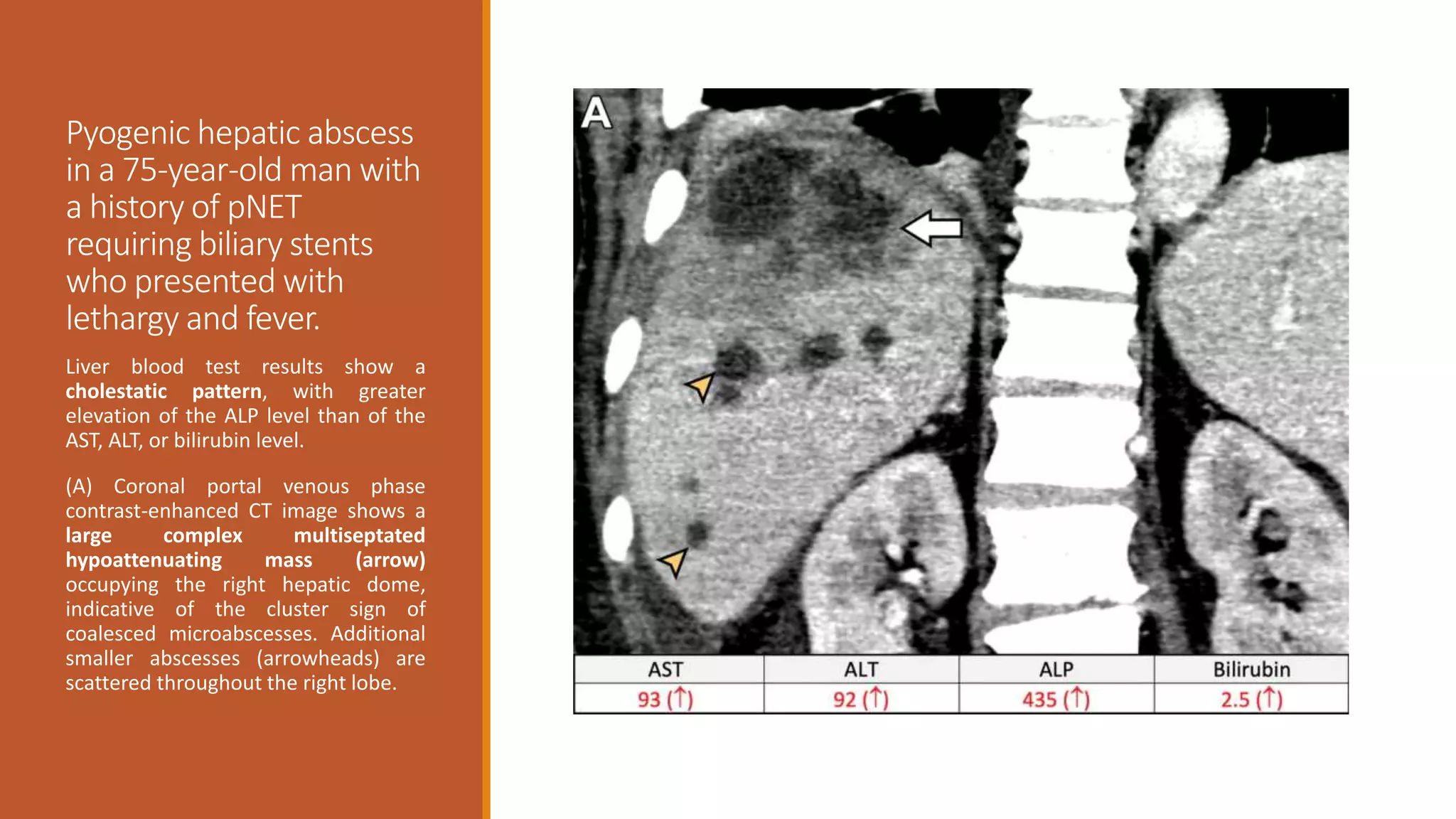 Beyond LFT - A Radiologist’s Guide to the Liver Blood Tests | PPTX ...
