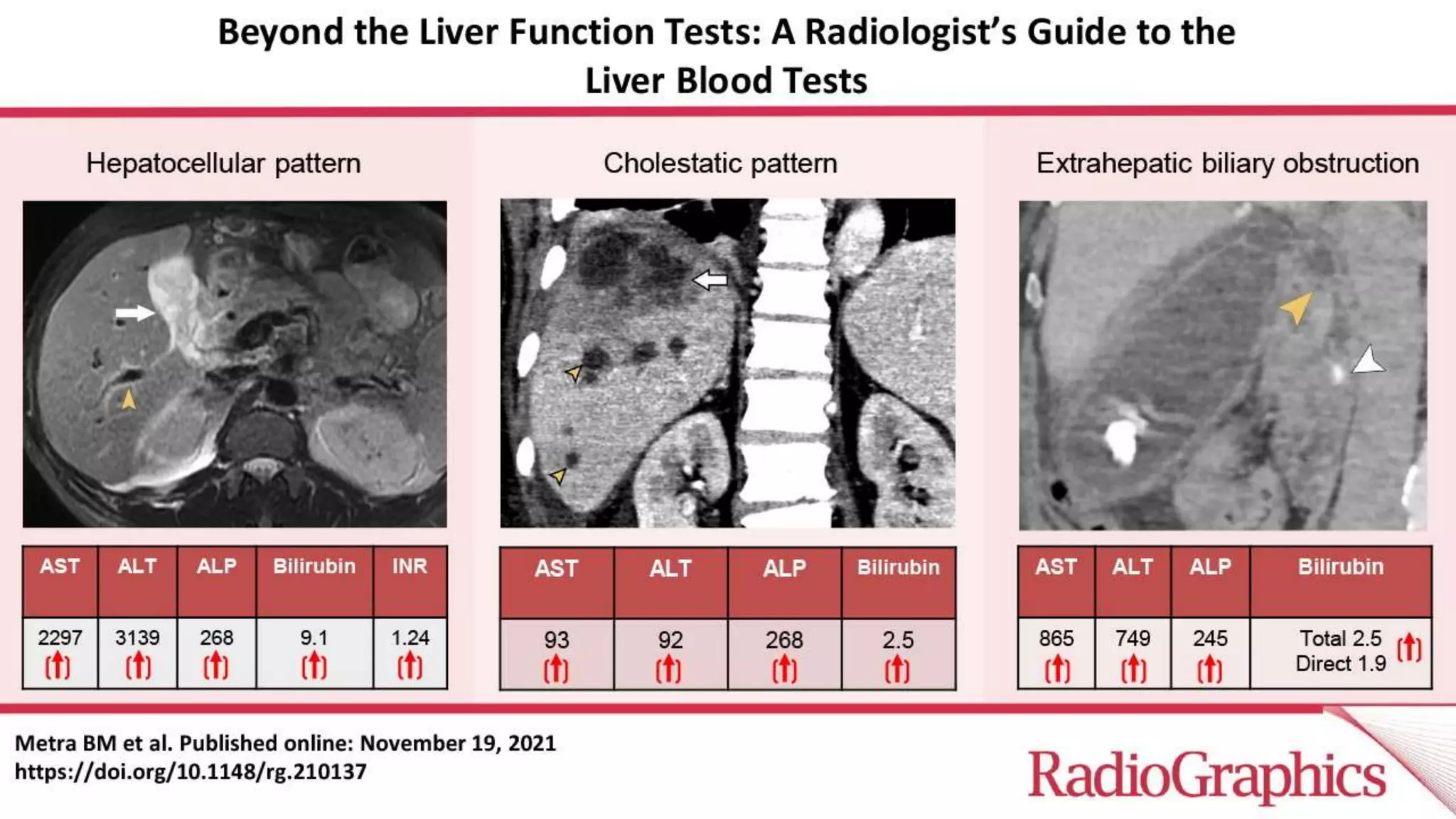 Beyond LFT - A Radiologist’s Guide to the Liver Blood Tests | PPT