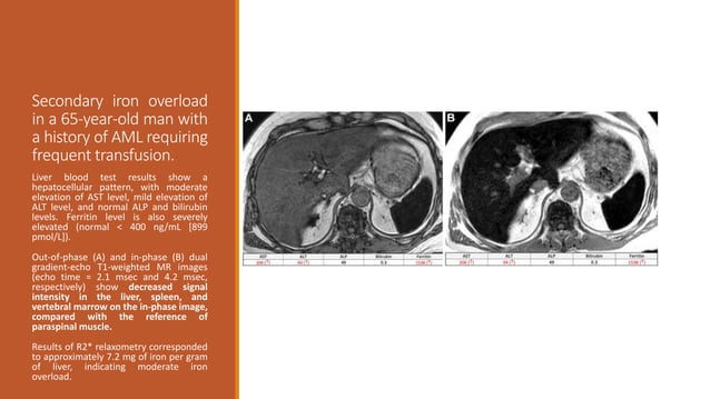 Beyond LFT - A Radiologist’s Guide to the Liver Blood Tests | PPTX ...