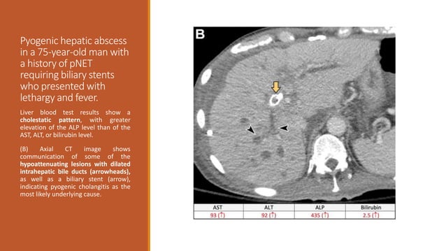 Beyond LFT - A Radiologist’s Guide to the Liver Blood Tests | PPTX ...