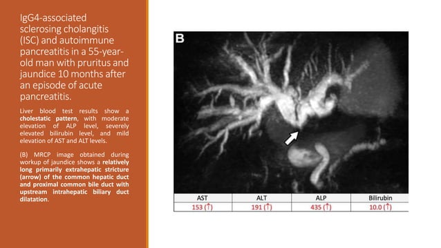 Beyond LFT - A Radiologist’s Guide to the Liver Blood Tests | PPTX ...