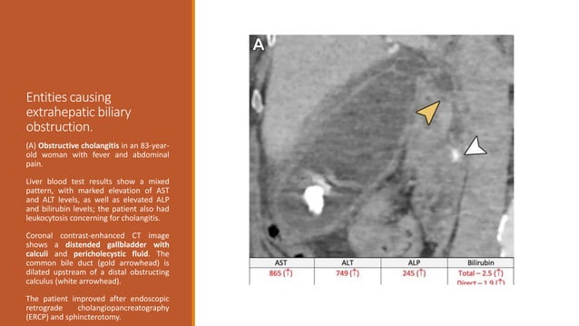 Beyond LFT - A Radiologist’s Guide to the Liver Blood Tests | PPT