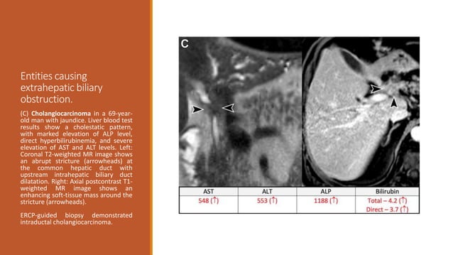 Beyond LFT - A Radiologist’s Guide to the Liver Blood Tests | PPTX ...