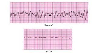 Beyond the protocol | PPT