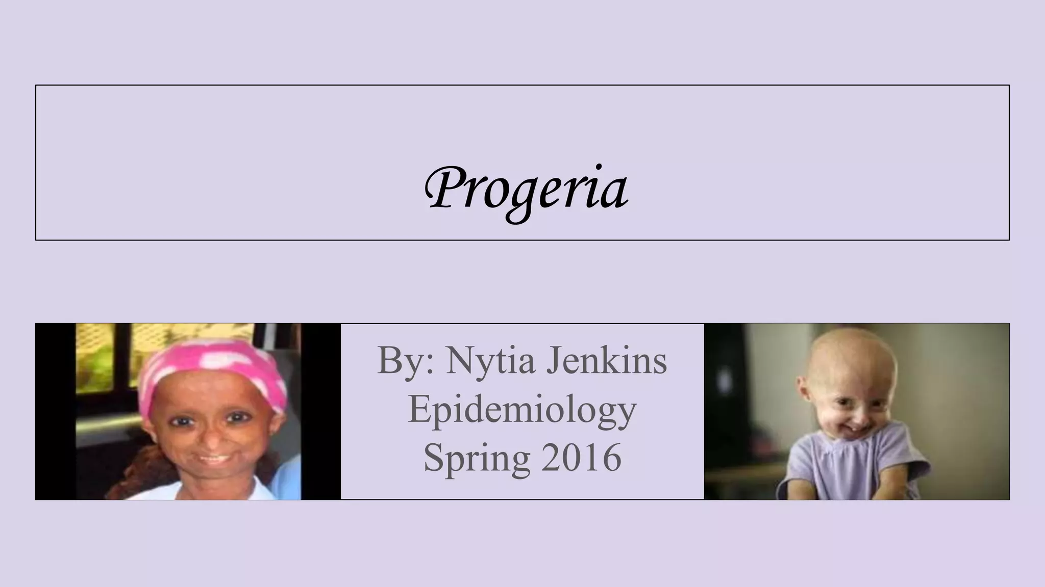 Progeria Power Point Edited | PPTX