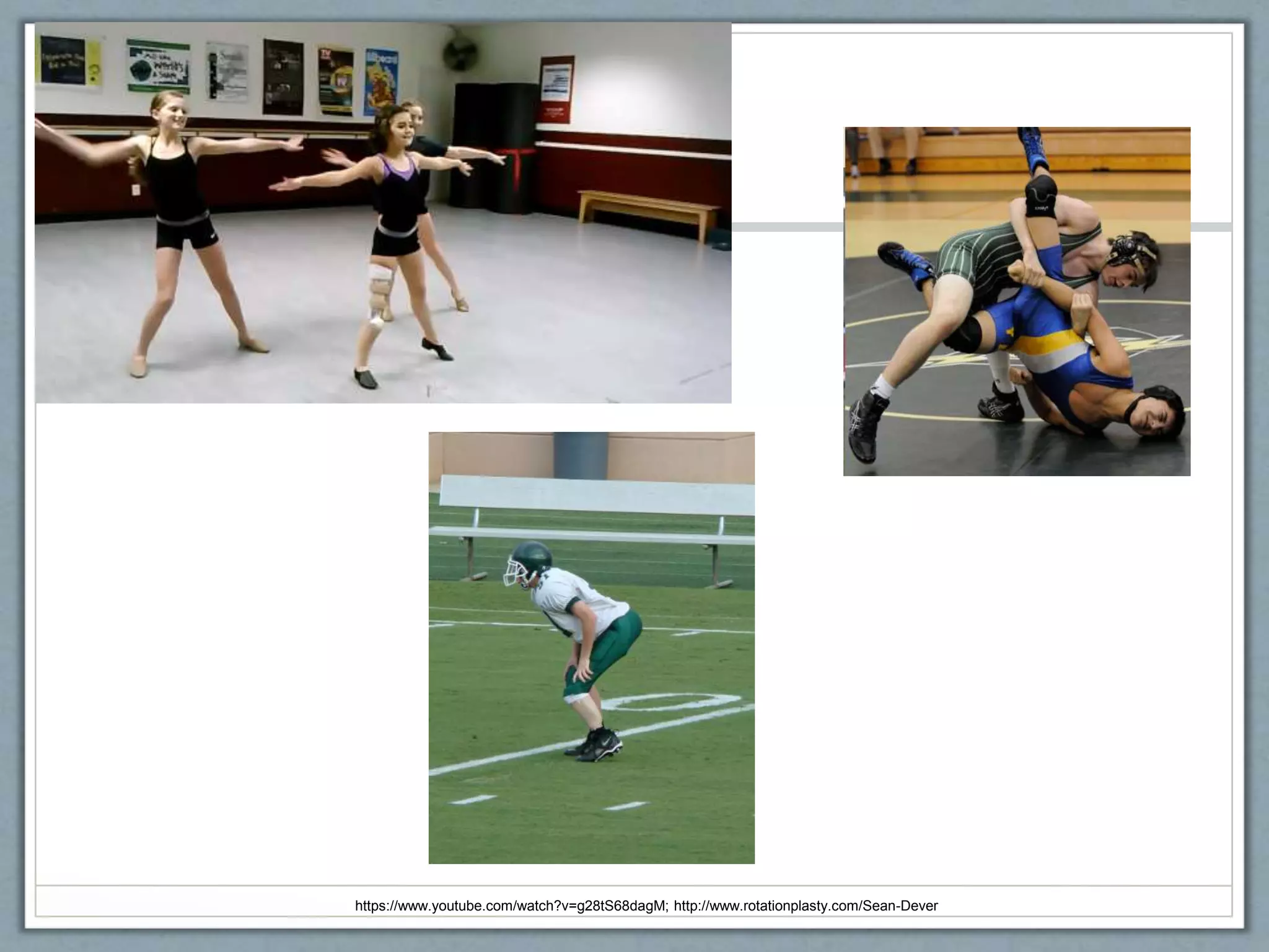 Rotationplasty | PPTX