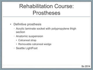 Rotationplasty | PPTX