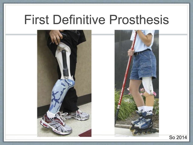 Rotationplasty | PPTX