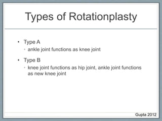 Rotationplasty | PPTX