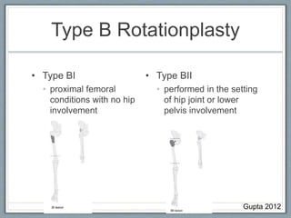Rotationplasty | PPTX