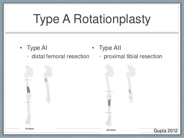 Rotationplasty