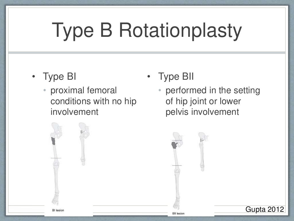 Rotationplasty Video