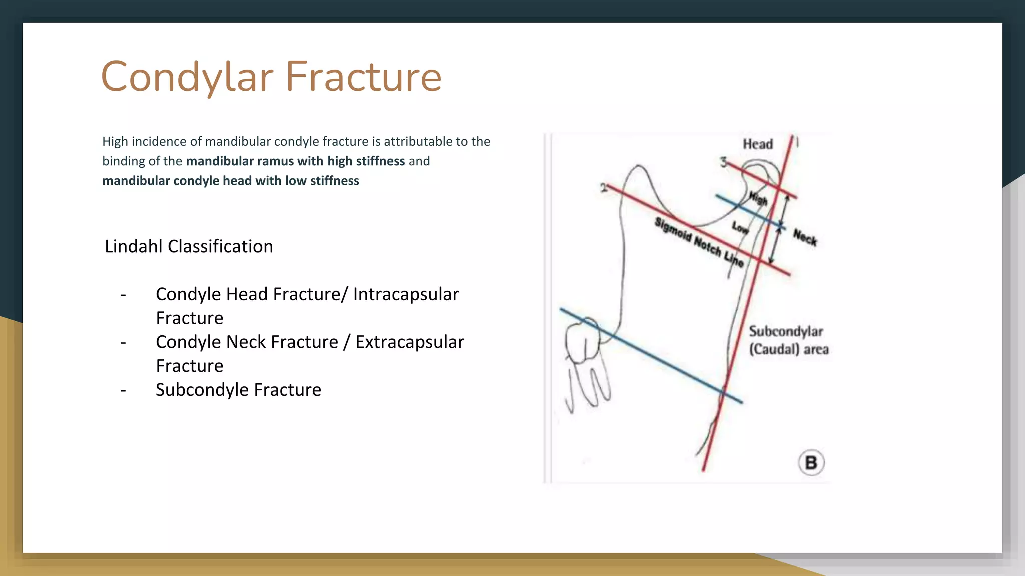 B_Fraktur Orokraniofasial.pptx
