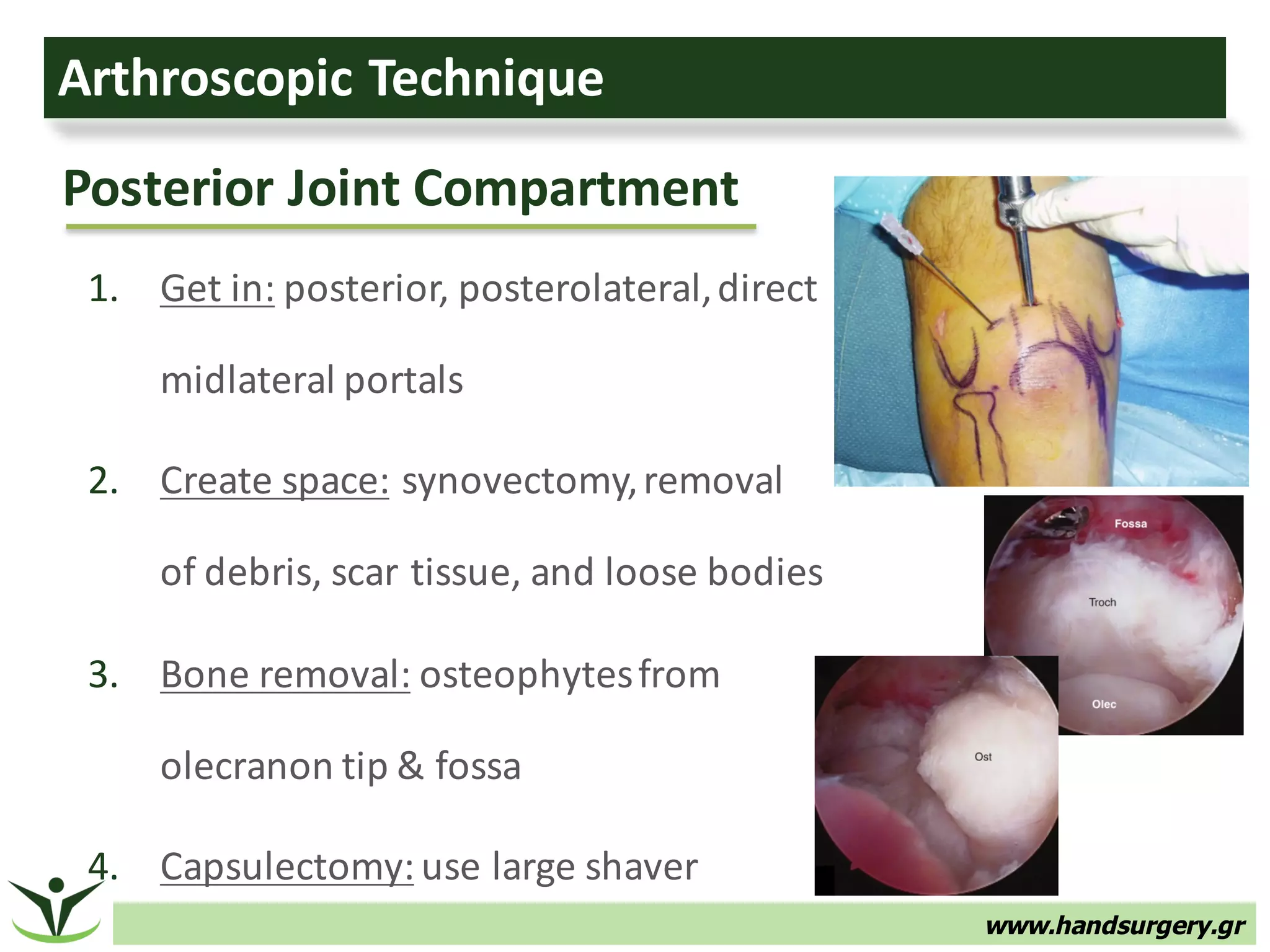 Arthroscopic management of arthritic elbow | PPT