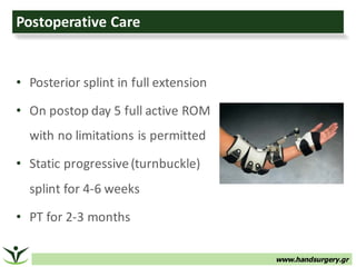 Arthroscopic management of arthritic elbow | PPT