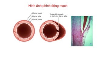 BG-tim mach.ppt