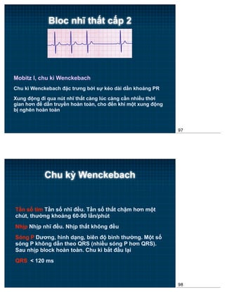 Điện tâm đồ cơ bản | PDF