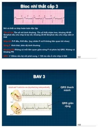Điện tâm đồ cơ bản | PDF