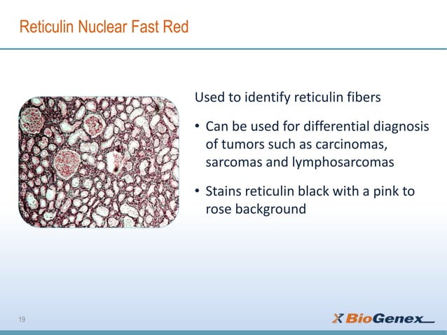 Pathology Special Stains for FFPE Tissue Staining | PPT